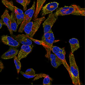 High Content Screening (HCS) with AI & ML: Redefining Drug Discovery